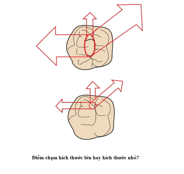 Bài 6-Phần 4: Nguyên lý chung và chỉnh khớp răng cối lớn, nhỏ răng hàm ...
